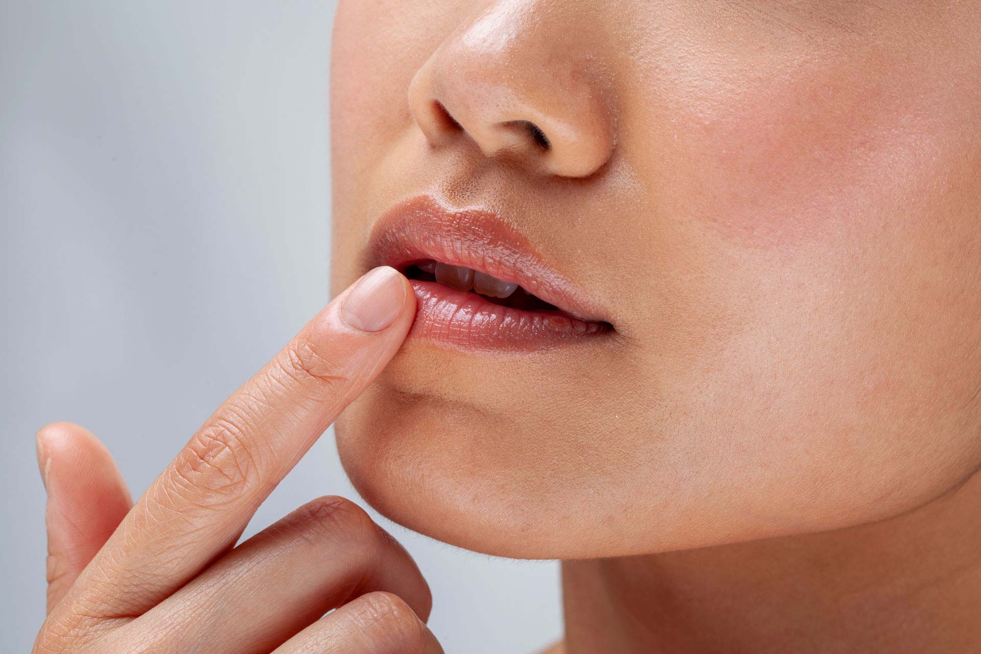 Labbra - Dr. Francesco Fiducia